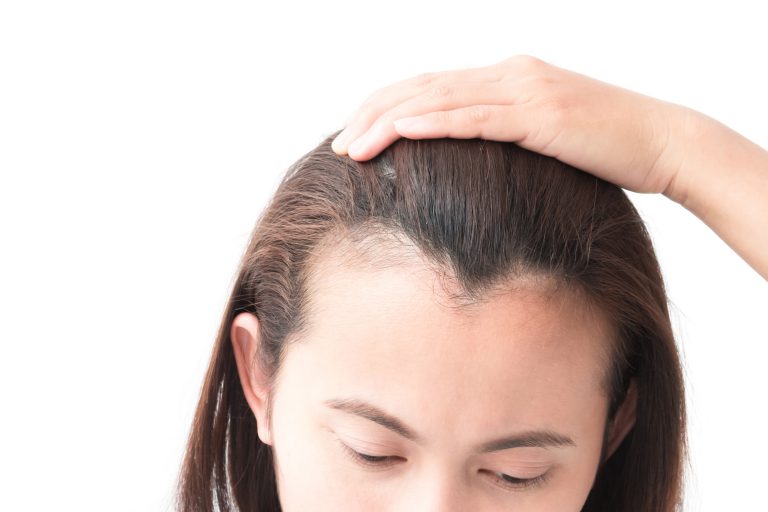 Entradas no cabelo? Dois truques fáceis para lidar com este problema ...